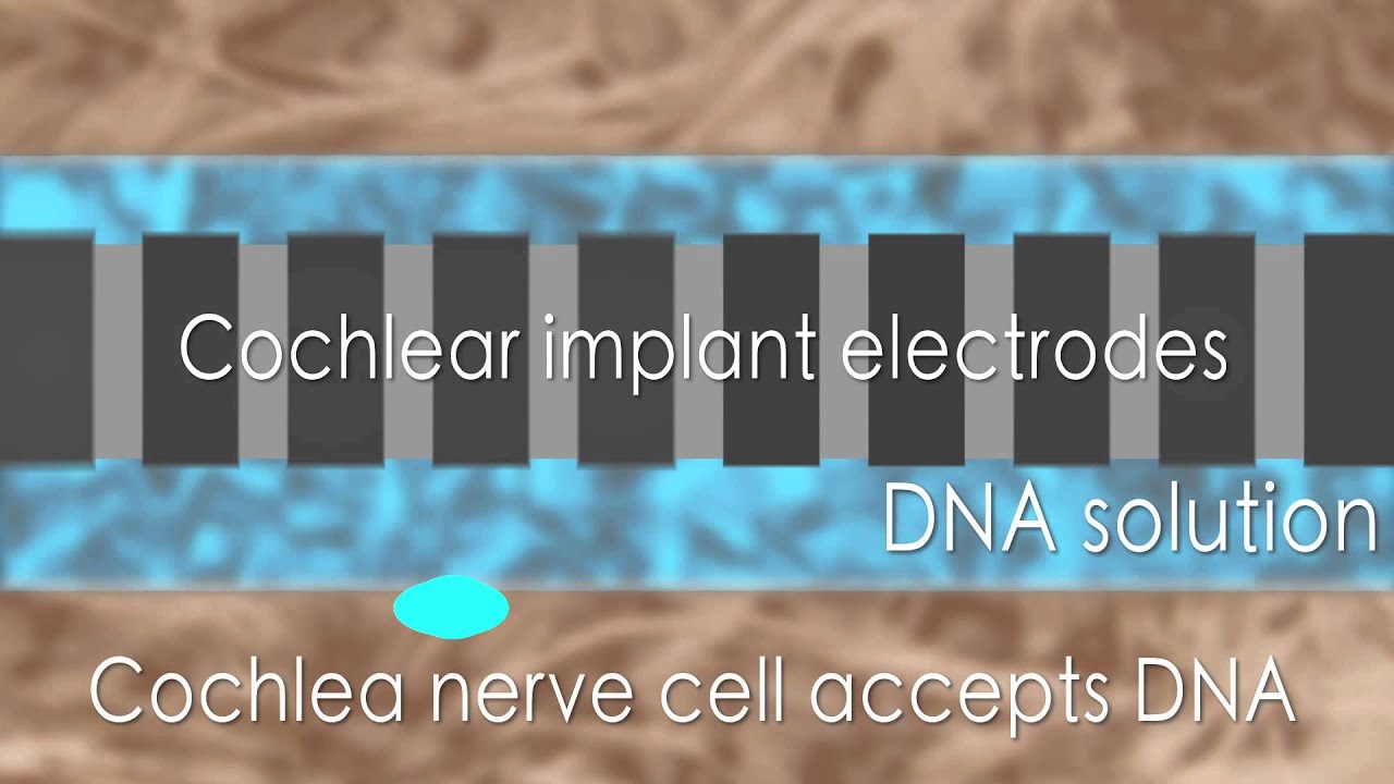 Cochlear implant delivers DNA for nerve cell regrowth - ANIMATION - YouTube