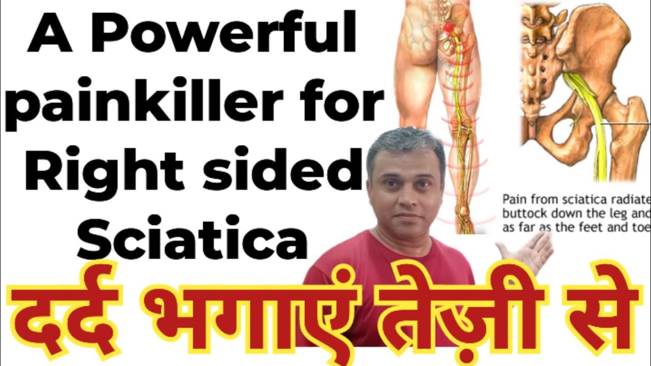 Quick Relief from Right sided Sciatica || Top Homeopathic medicine ...