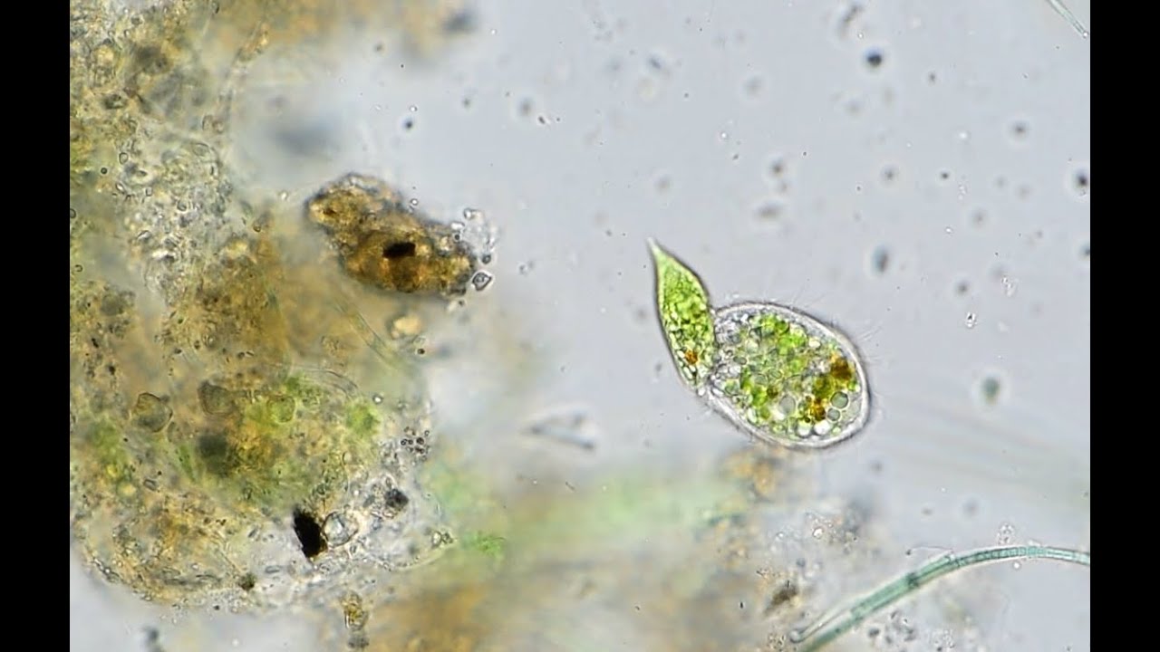 freshwater ciliate eating algae - YouTube