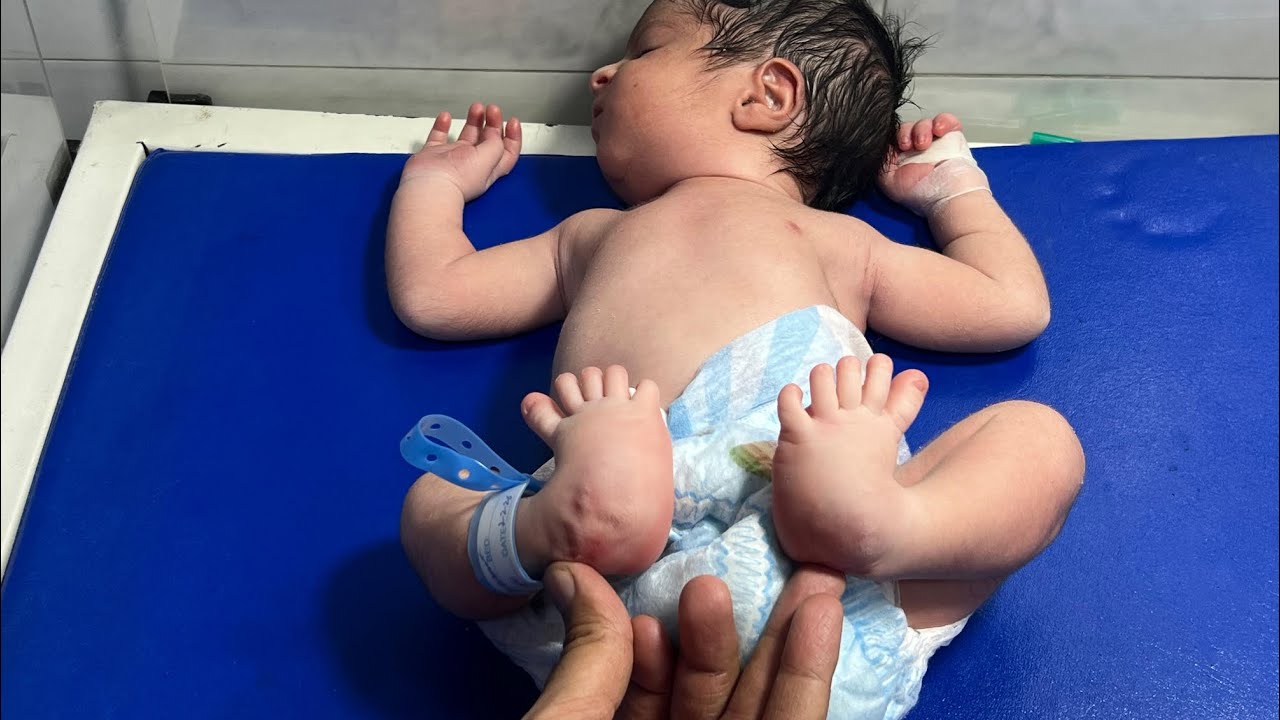 Cleft Foot Baby in NICU | A Journey of Hope & Care - YouTube