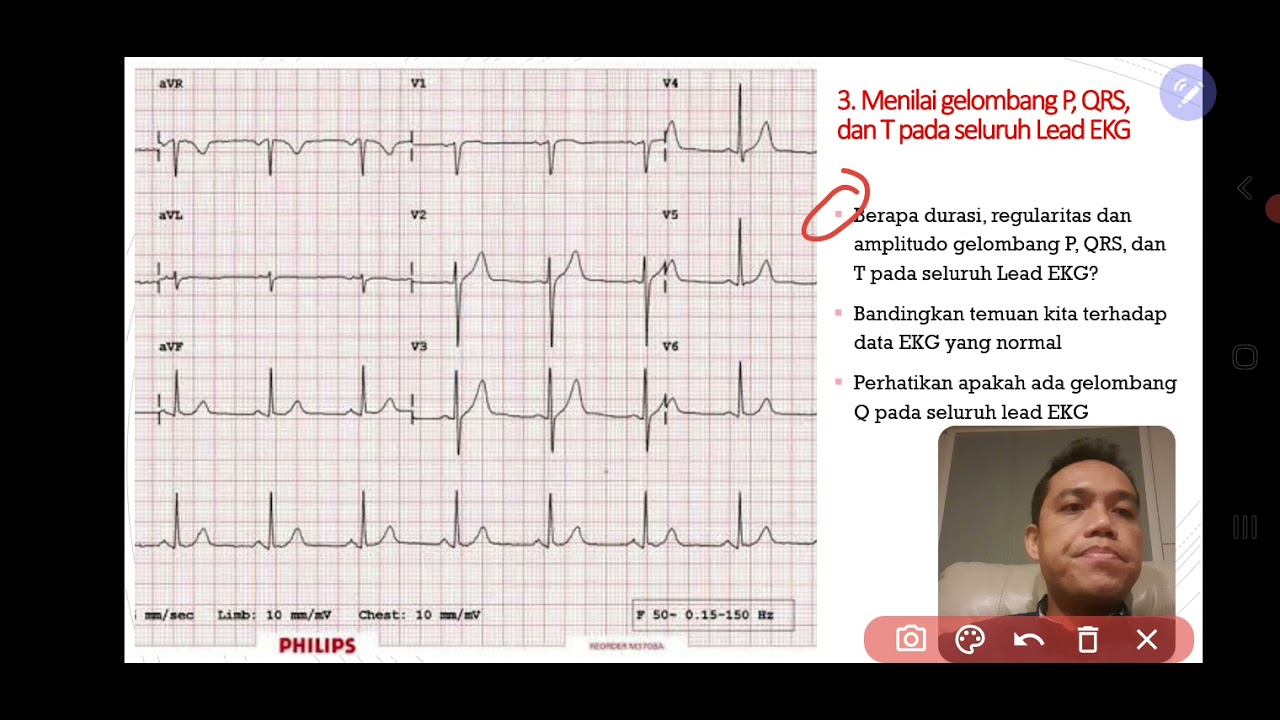 How to READ EKG or ECG - Skills Lab - YouTube