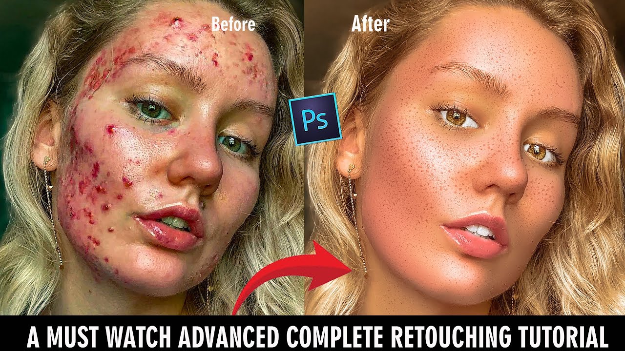 How to Retouch Acne & Pimples | Professional Beauty Retouching Tutorial ...