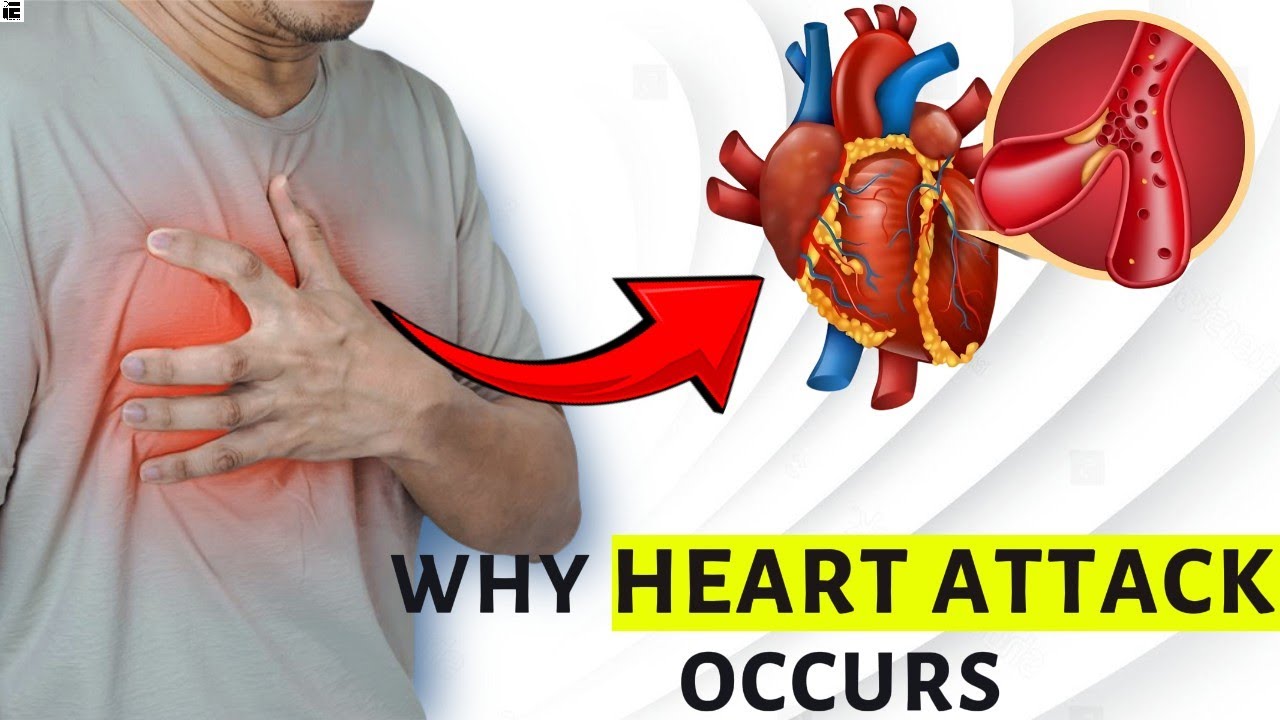 Your Heart Under Attack - What You NEED to Know - YouTube