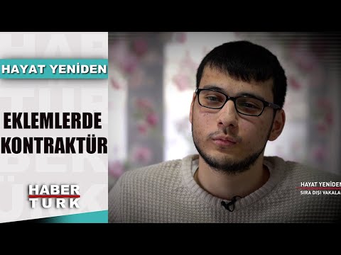 Eklemlerde kontraktür nedir? | Hayat Yeniden - 9 Şubat 2020