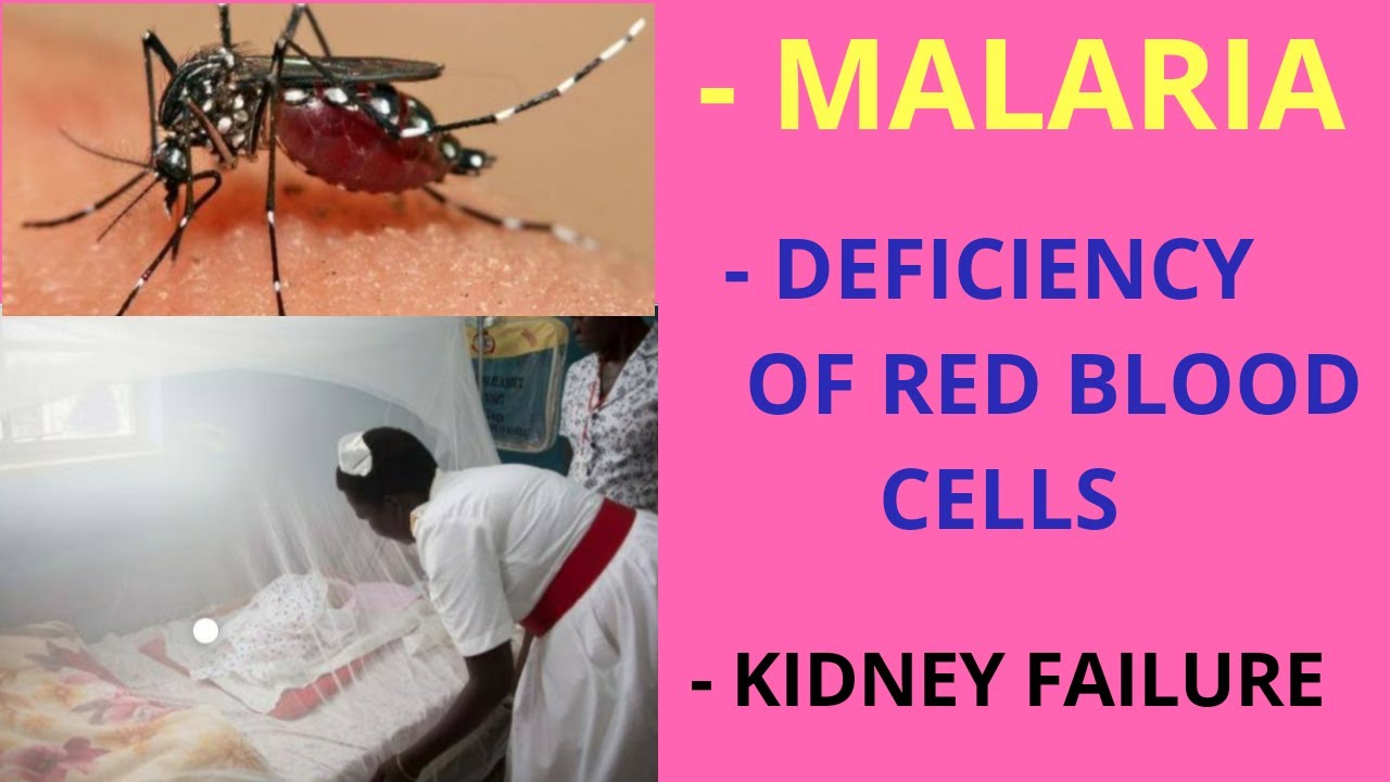 MALARIA, DEFICIENCY OF RED BLOOD CELLS, KIDNEY FAILURE! - YouTube