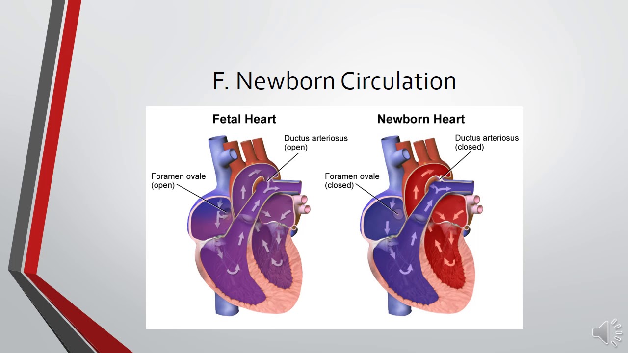 Neonatal Critical Care Review: Cardiology, Part 1 Anatomy - YouTube