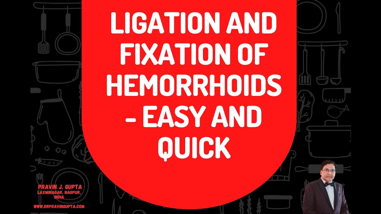 LIGATION AND FIXATION OF HEMORRHOIDS- EASY AND QUICK - YouTube
