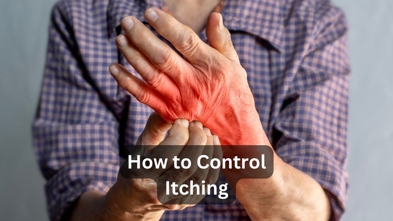 How to Stop Itching Skin from Psoriasis? | Expert Tips by Dr. Rajendra ...