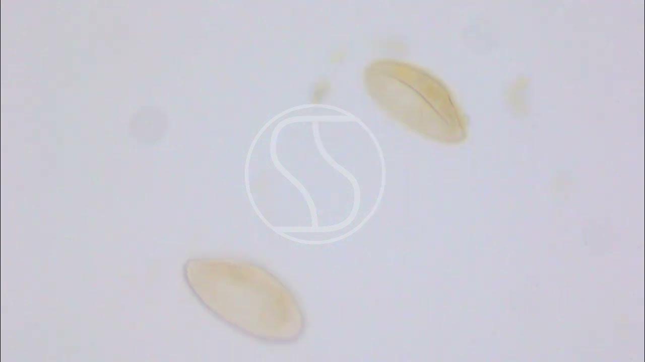 Enterobius vermicularis egg under the microscope - YouTube