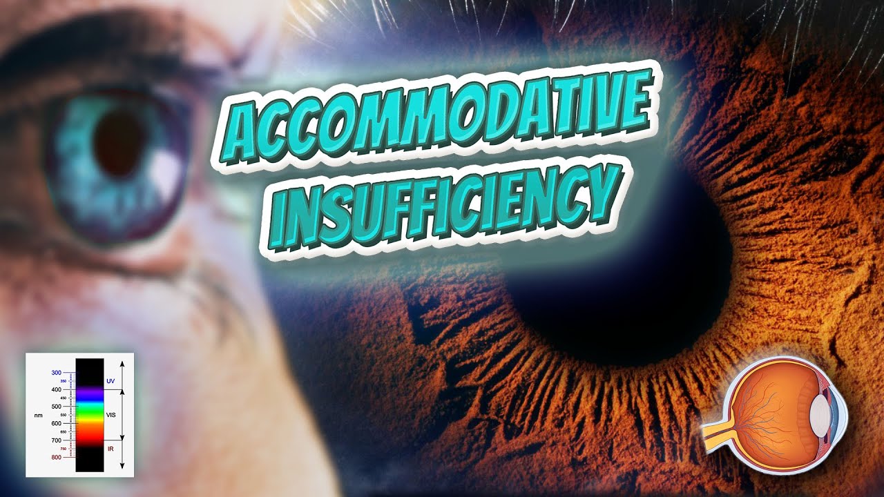 Accommodative insufficiency - Your EYEBALLS - EYNTK 👁️💉😳💊🔊💯 - YouTube