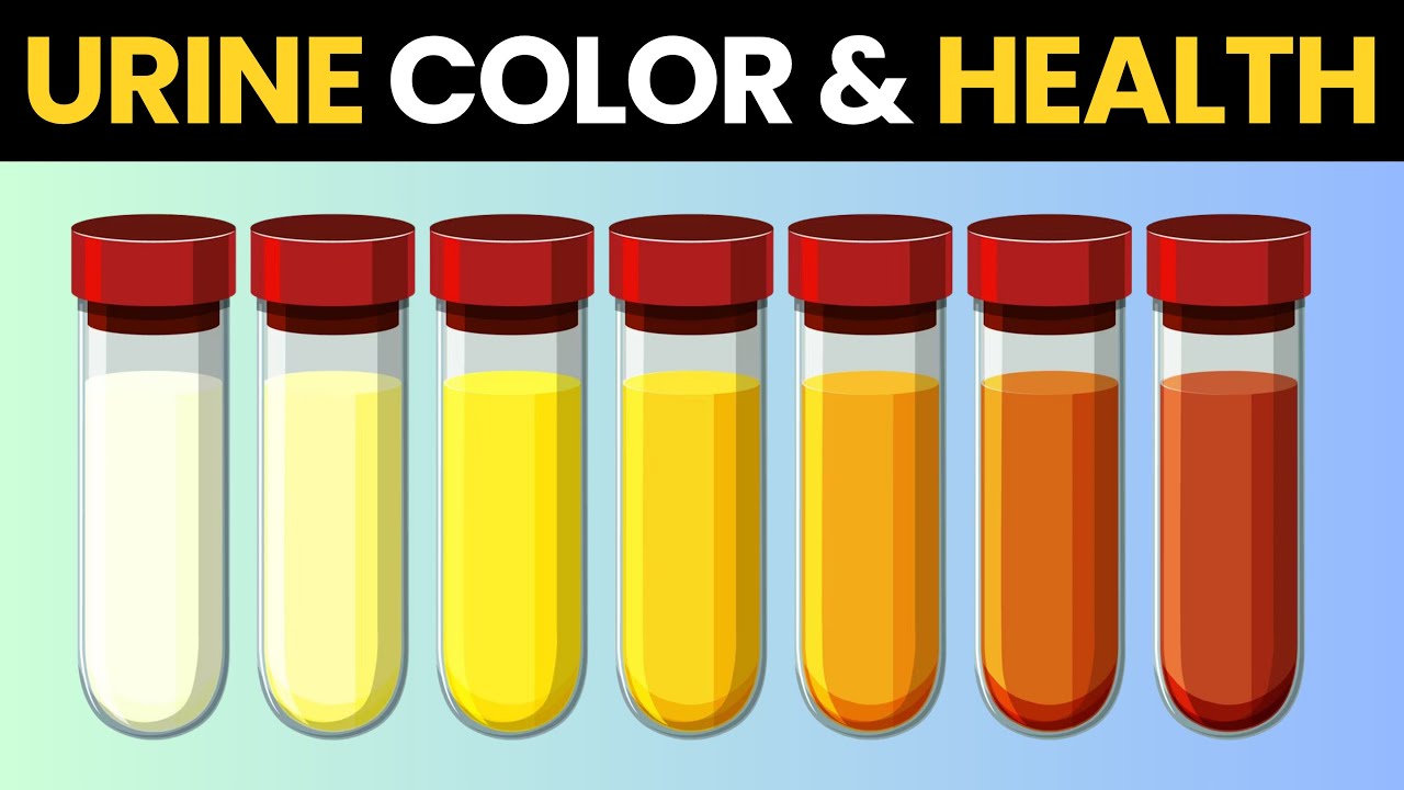 What The Color Of Your Urine Says About Your Health - YouTube