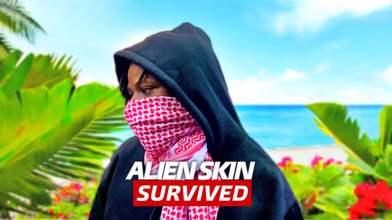 They Wanted To K*LL Alien skin In Dubai - YouTube