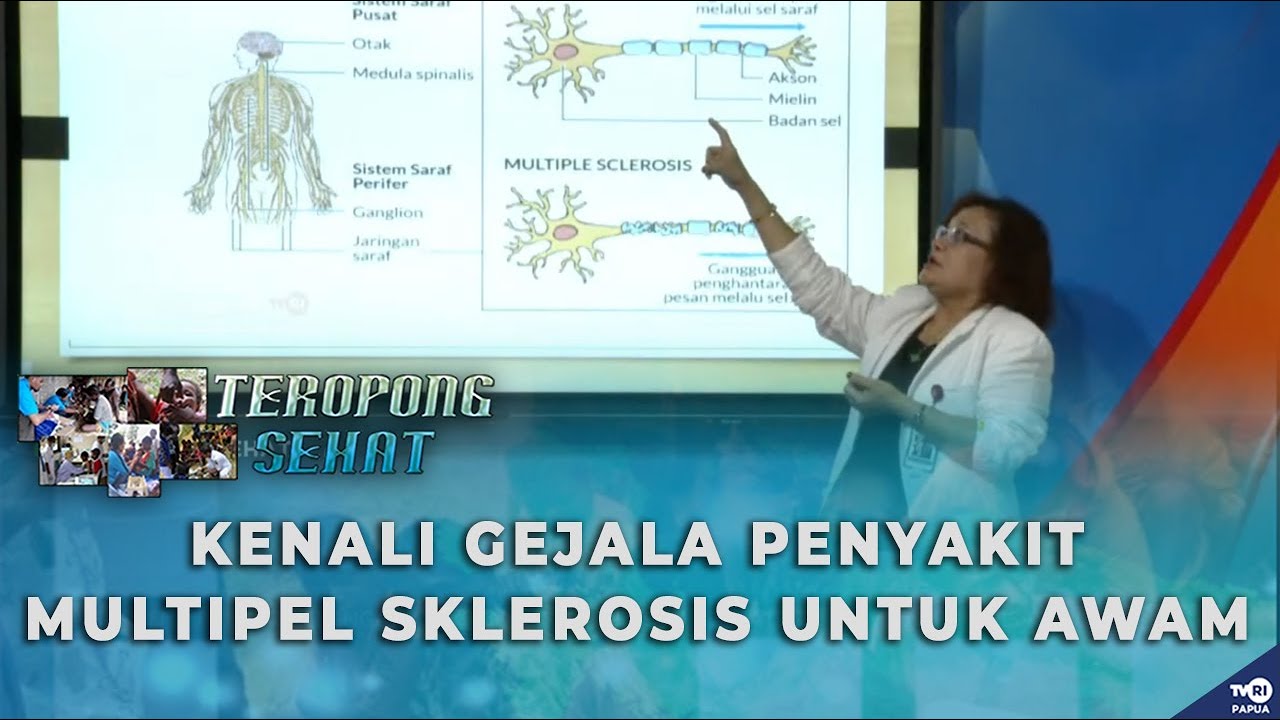 KENALI GEJALA PENYAKIT MULTIPEL SKLEROSIS UNTUK AWAM [TEROPONG SEHAT ...