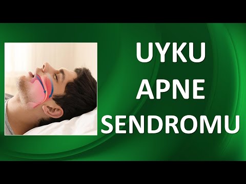 UYKU APNE SENDROMU NEDİR? NASIL TEDAVİ EDİLİR?