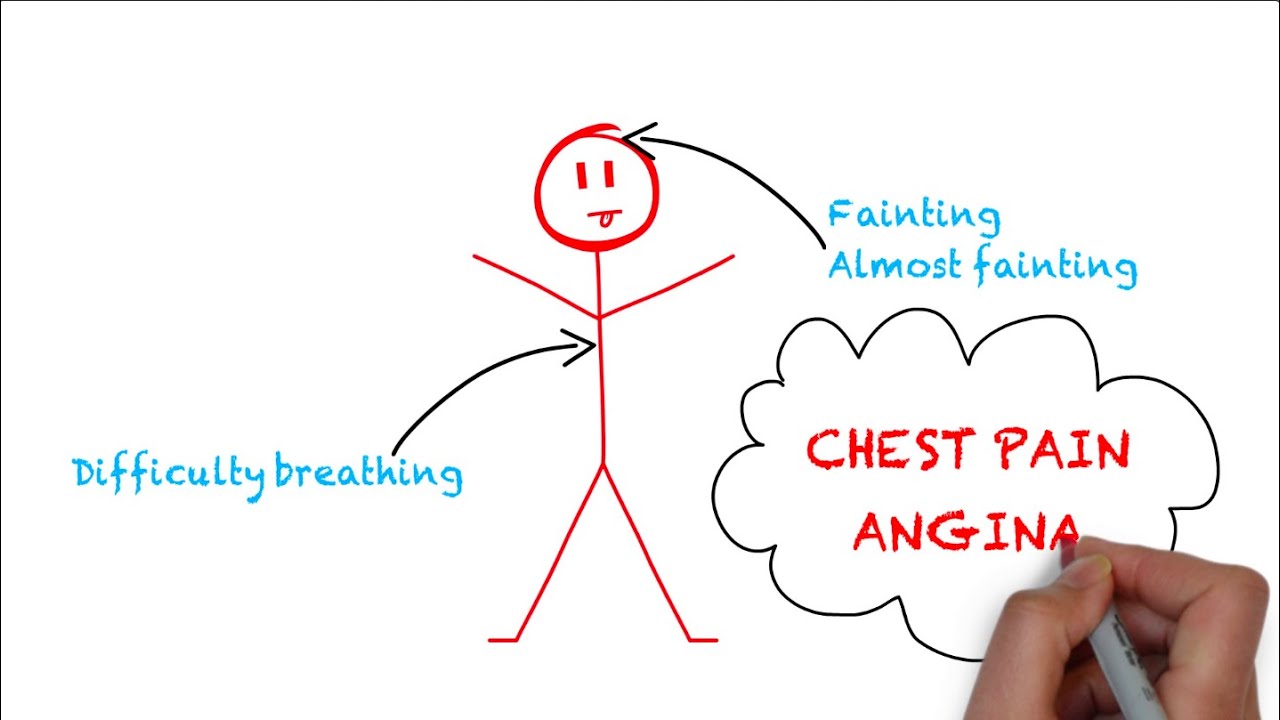 What are the symptoms of Atrial fibrillation? - YouTube