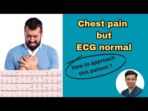 Chest Pain with Normal ECG | Don’t Relax Yet ! A Clinical Approach for ...