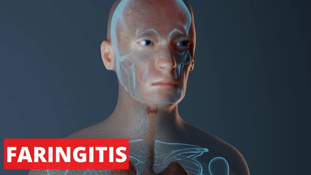 Las FARINGITIS explicada: síntomas, causas, tratamientos - YouTube