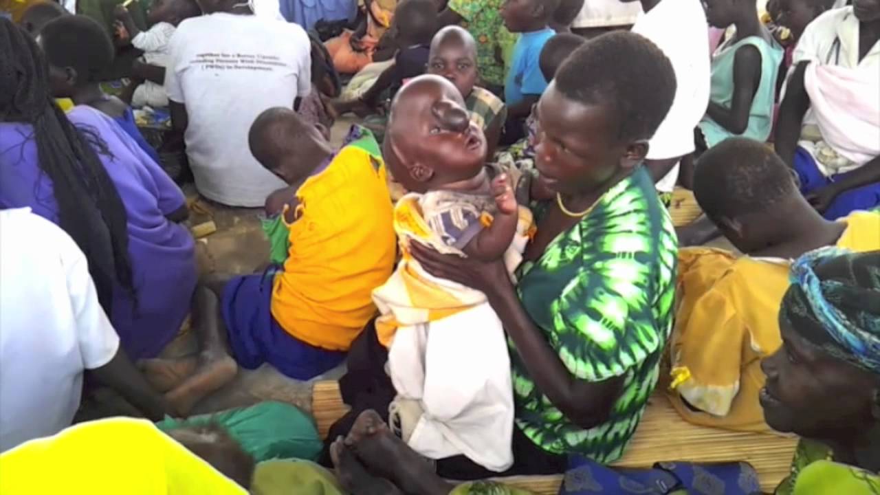 Nodding Disease - YouTube