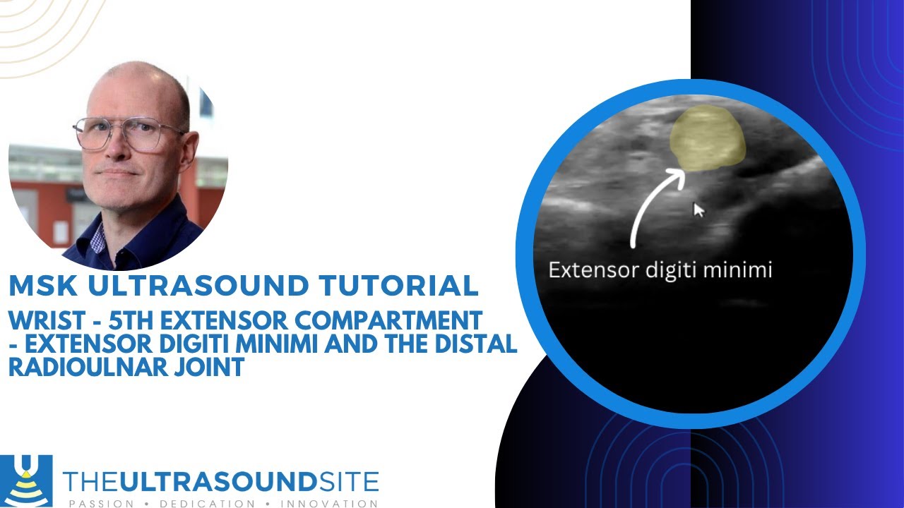 Use MSK ultrasound to explore the distal radioulnar joint and 5th ...