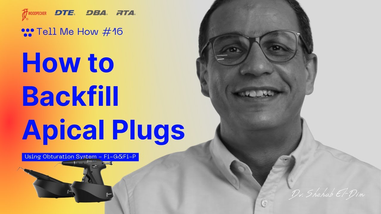 【Case Sharing】- How to Backfill Apical Plugs (by Dr. Shehab) - Fi-P&Fi ...