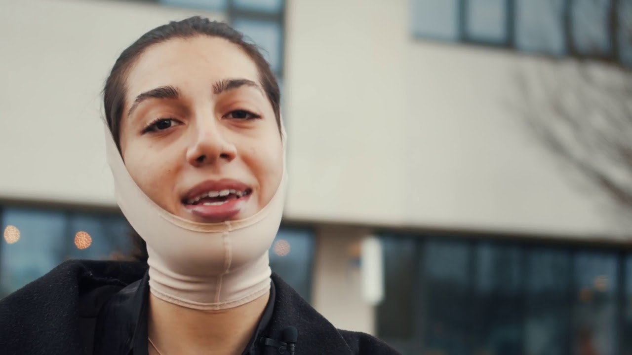 Patient's Journey - Nicole (Facial Feminisation Surgery) at The London ...