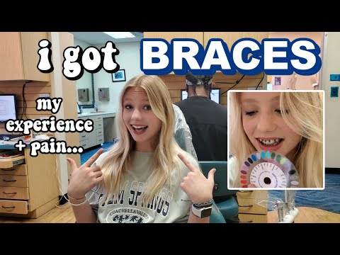 i got BRACES for the first time... *vlog* - YouTube