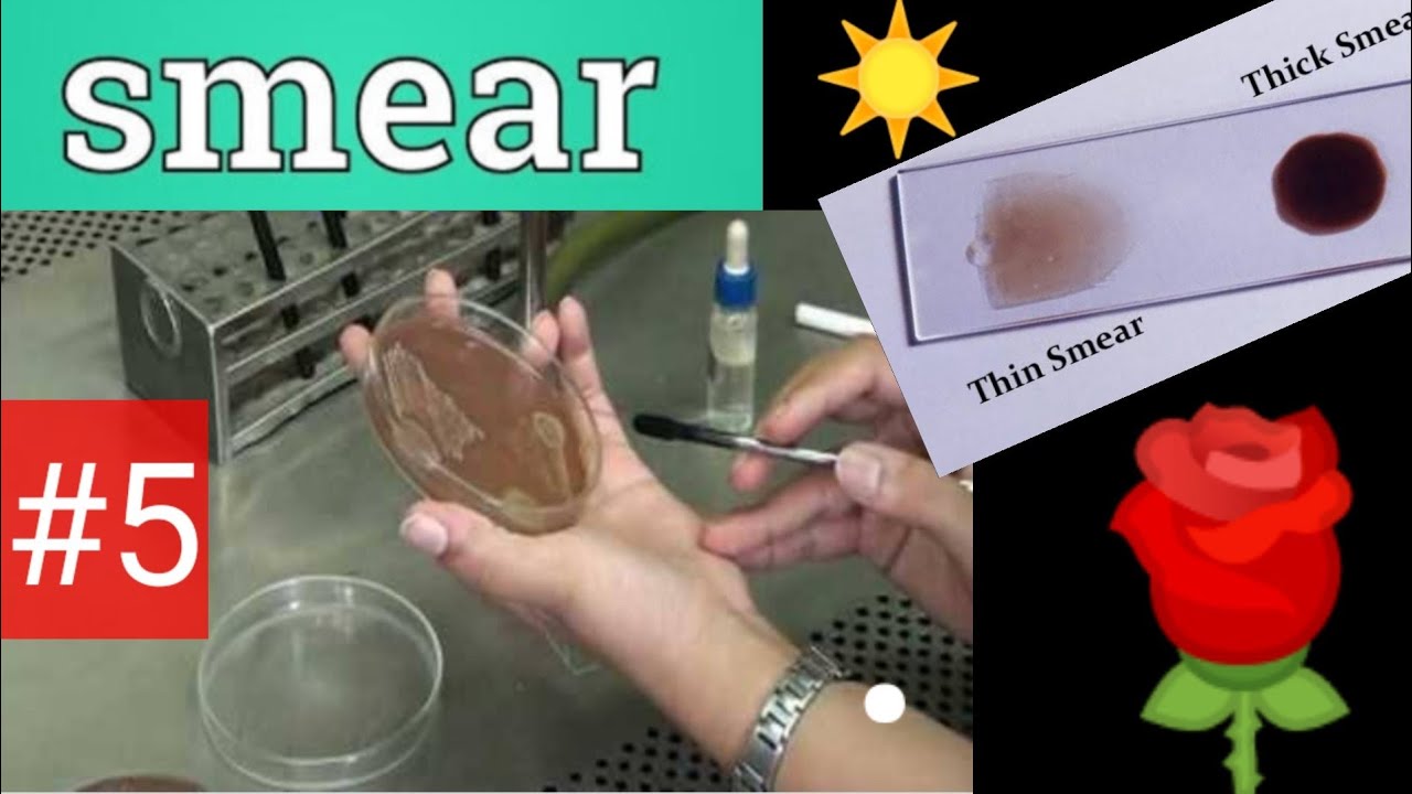 smear preparation microbiology. Smear making. in microbiology lab. ospe ...