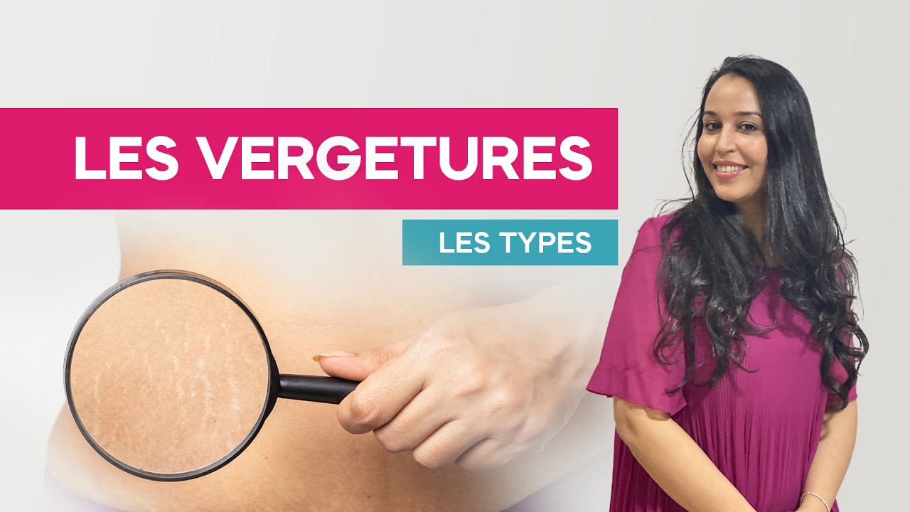 Dr. Hind HAIM: quels sont les types de vergetures? - 1 Moment - YouTube