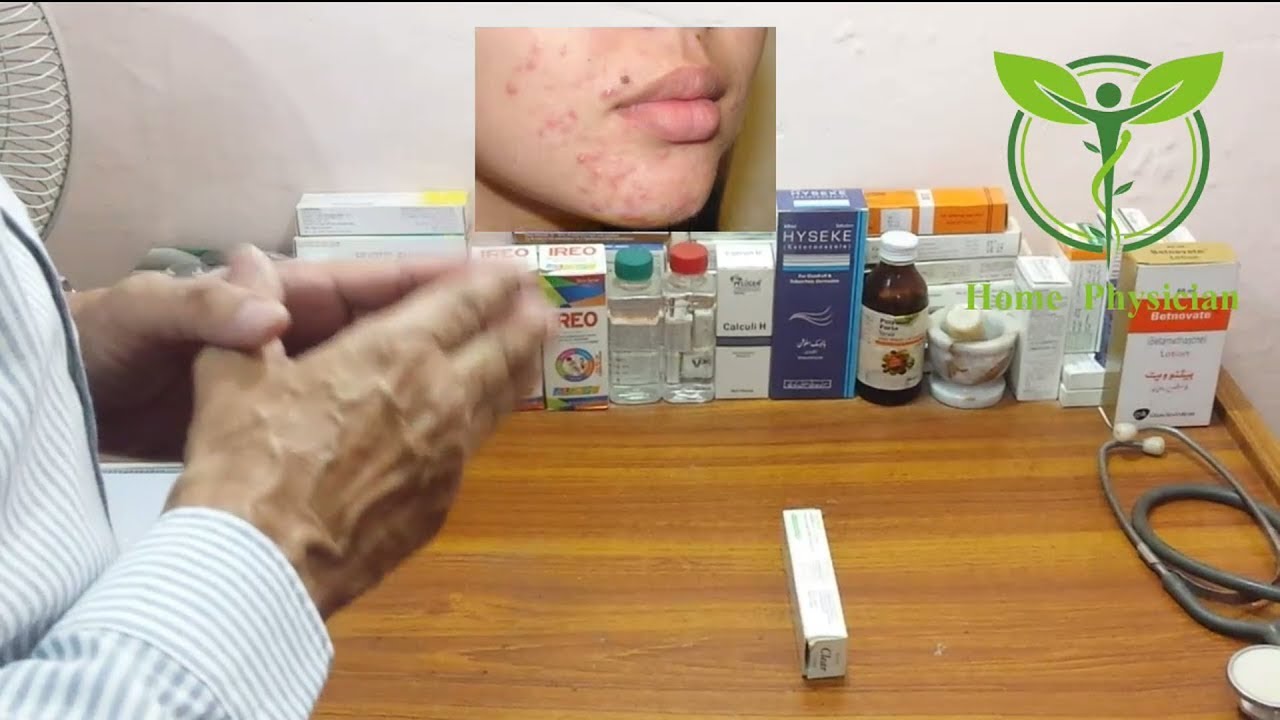 Kil Muhase Ka Musar Ilaj | Acne Removal Permanent Solution | Medicated ...