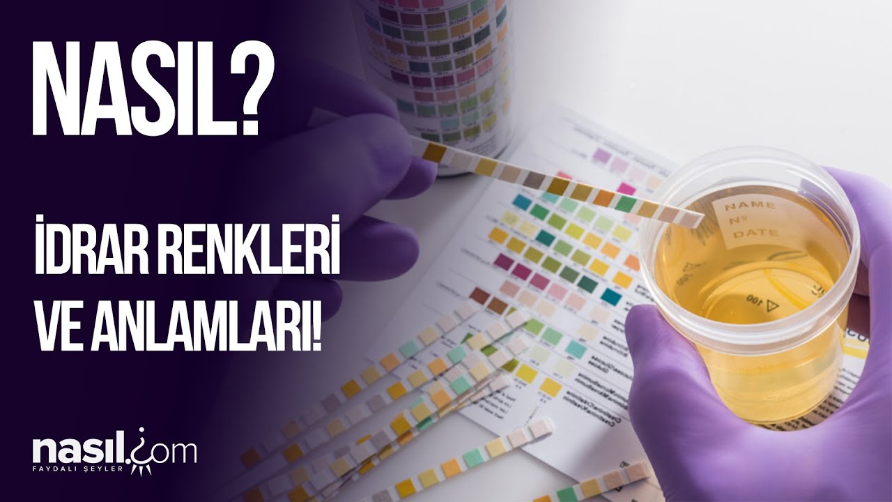 İdrar Renginiz Hangi Hastalığın Habercisi? İŞTE İDRAR RENKLERİ VE ...