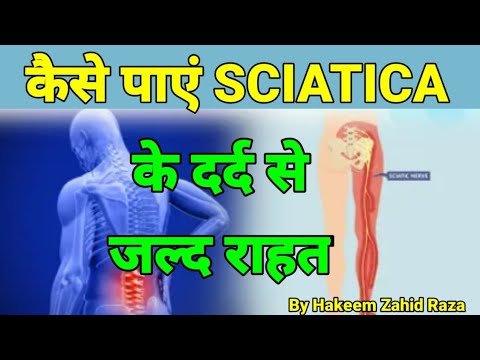 Sitica | Rangan | Langdi | Ke marz or Dard Ka Gharelu powerful Nuskha ||By Hakeem Mohd Zahid Raza