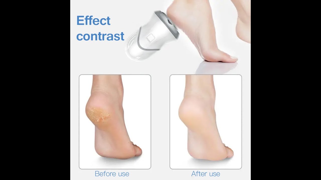 Electric foot sharpener to remove dead skin and calluses - YouTube