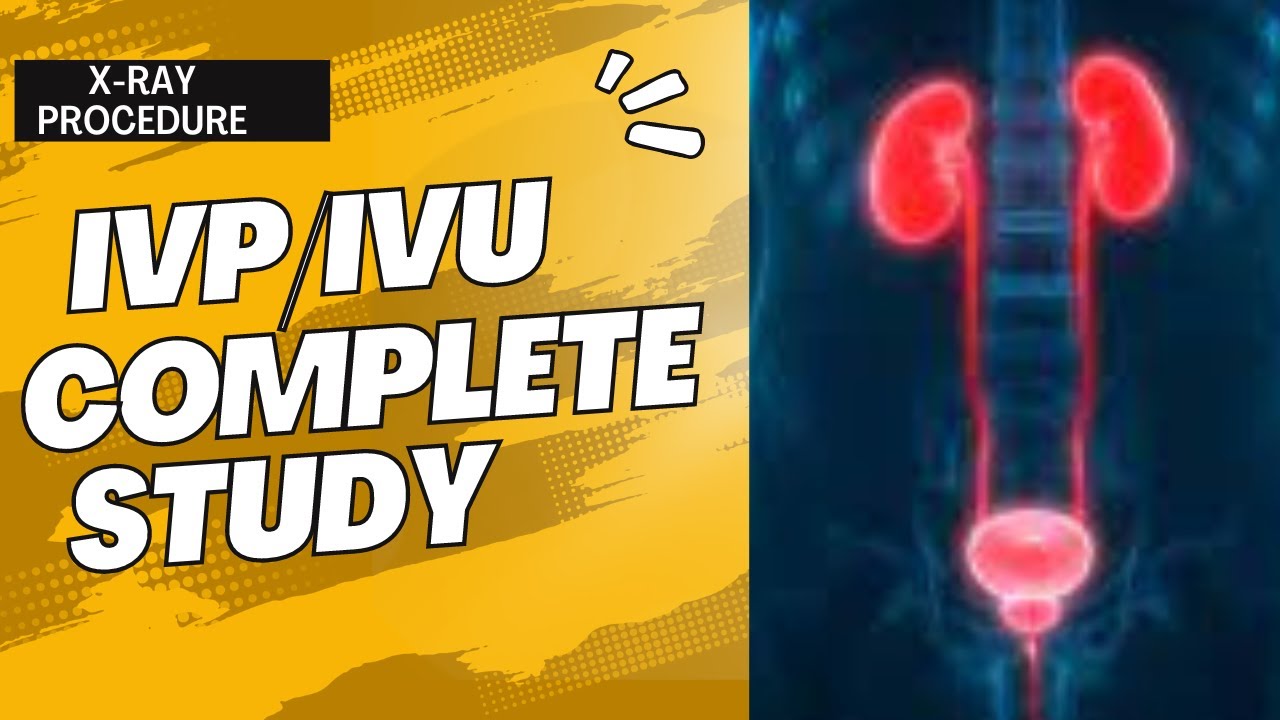 IVU/IVP X-ray Procedure in | Intravenous Urography| Intravenous ...