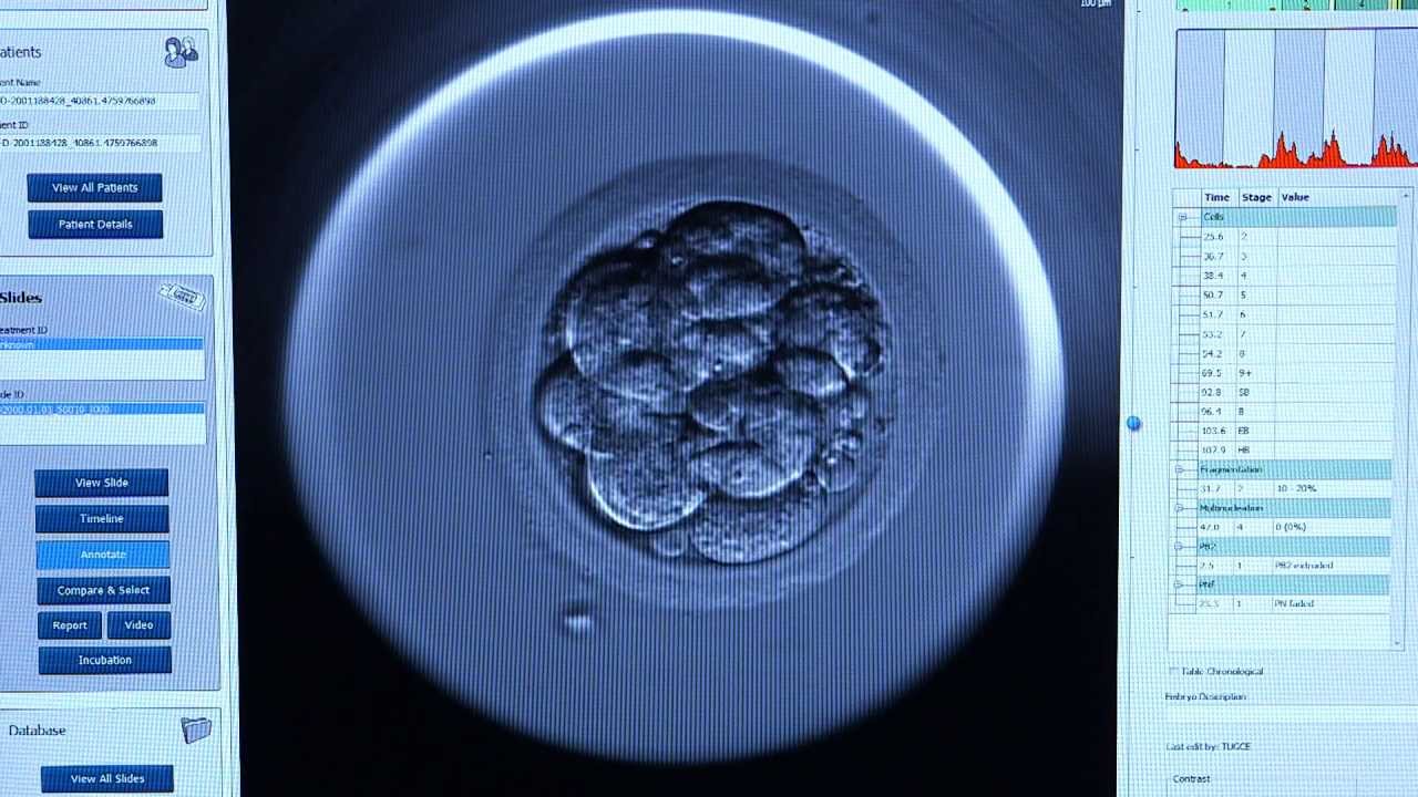Embryoscope™ - CREATE Fertility - YouTube