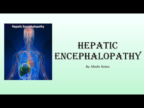 [Gastroenterology] Hepatic encephalopathy, West Haven classification ...