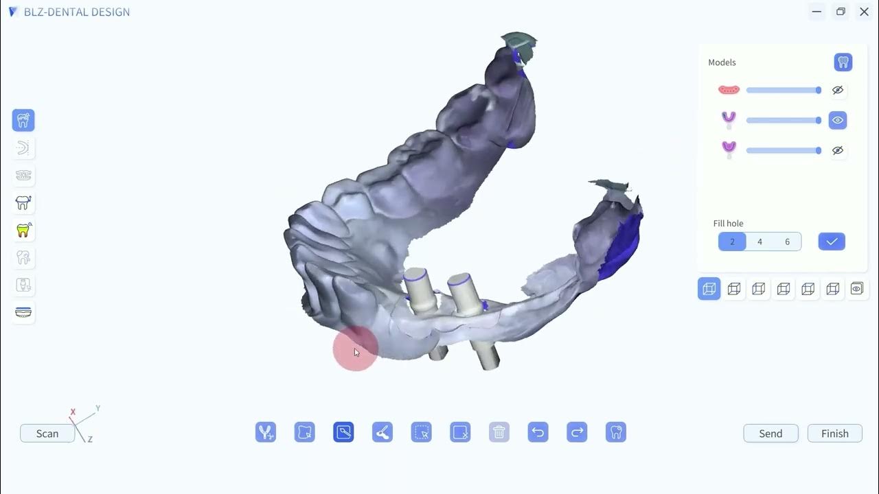 BLZ Dental LS200 Series | Implant & Impression Scanning-Implant Analog Scanning Guidelines - YouTube