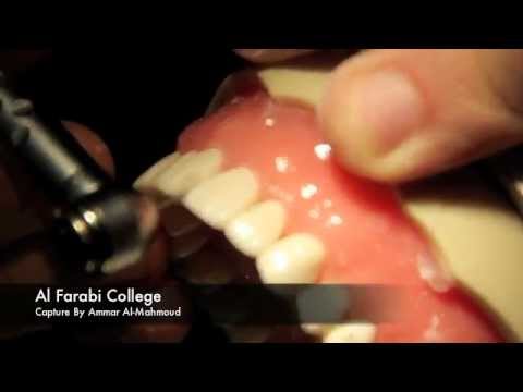 Class IV Preparation & Restoration ( Composite ) .. Al-Farabi College ...