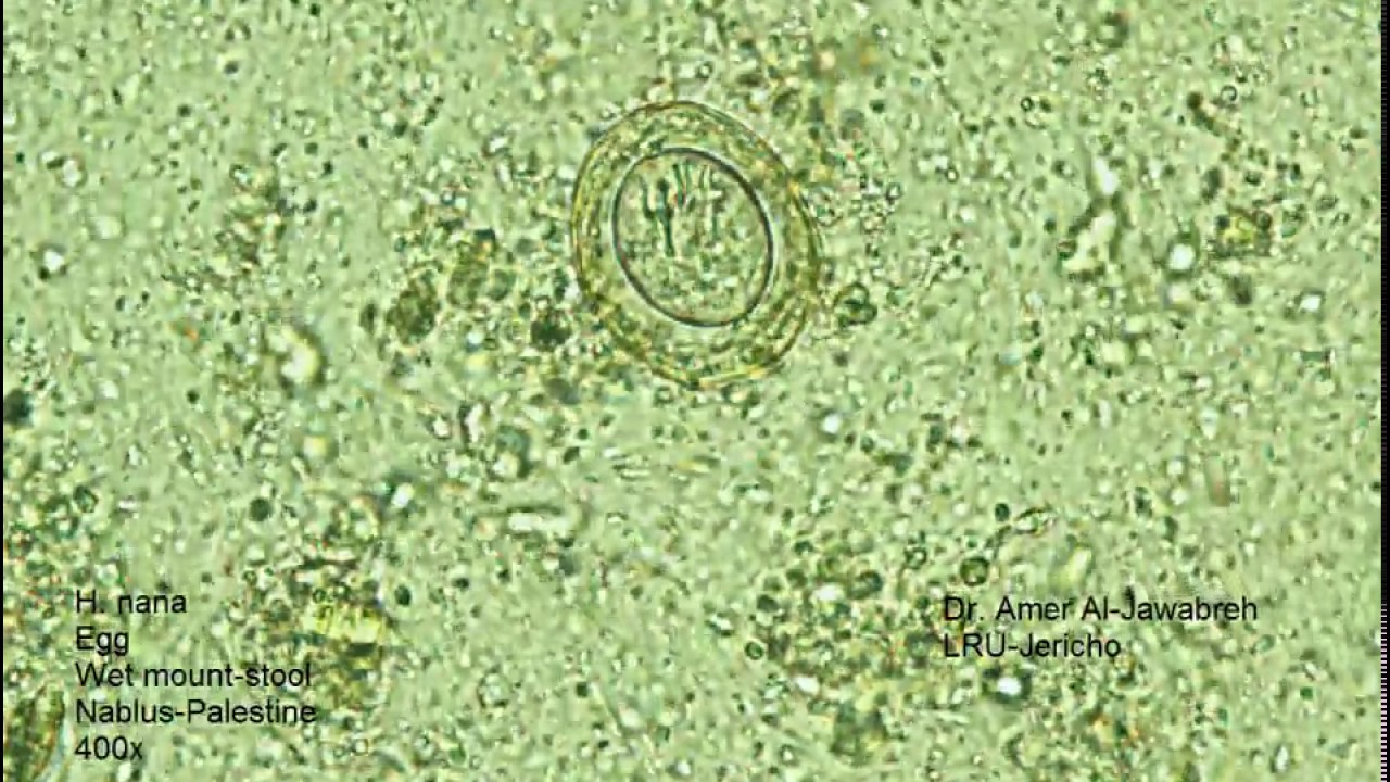 Hymenolepis Nana Cisticercoide