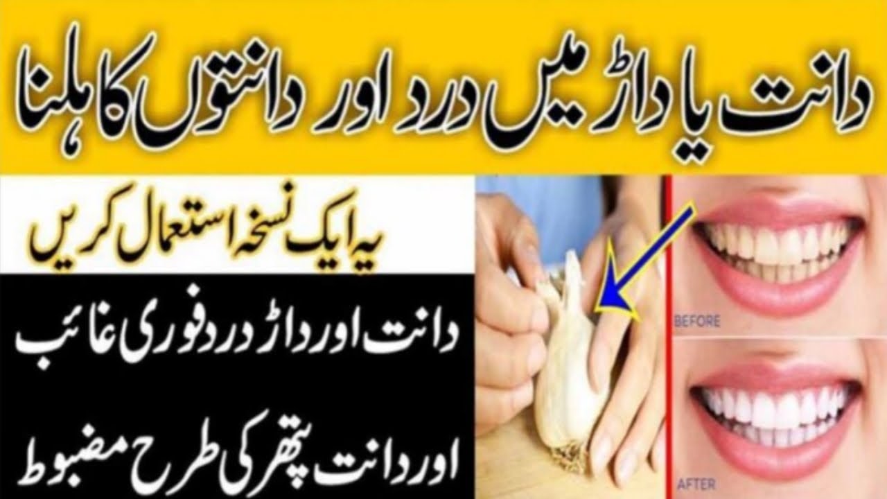 Dant ya Dar Ka Dard Aur Danto Ka Hilna Mazeed Janiye - YouTube