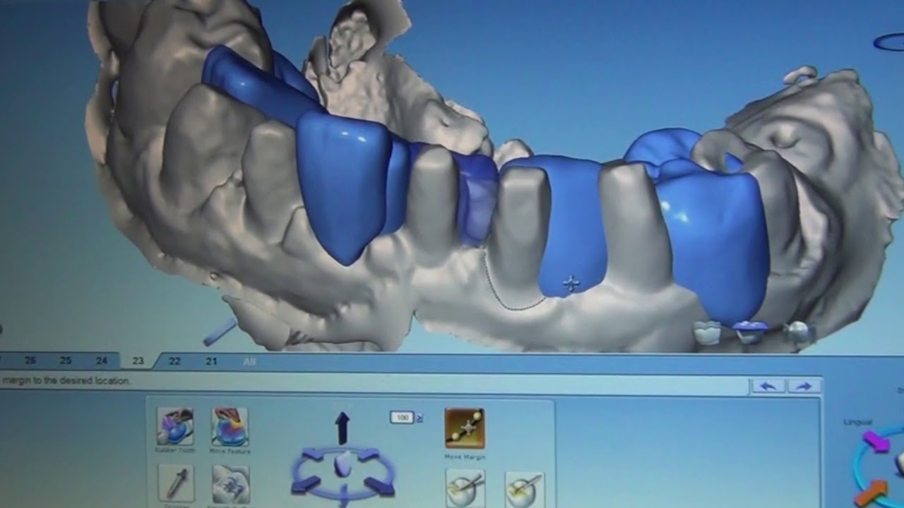 Problems with E4D technology software. - YouTube