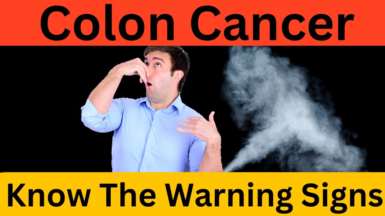 Colon Cancer Warning Signs - What Your Digestive Issues Are Telling You ...