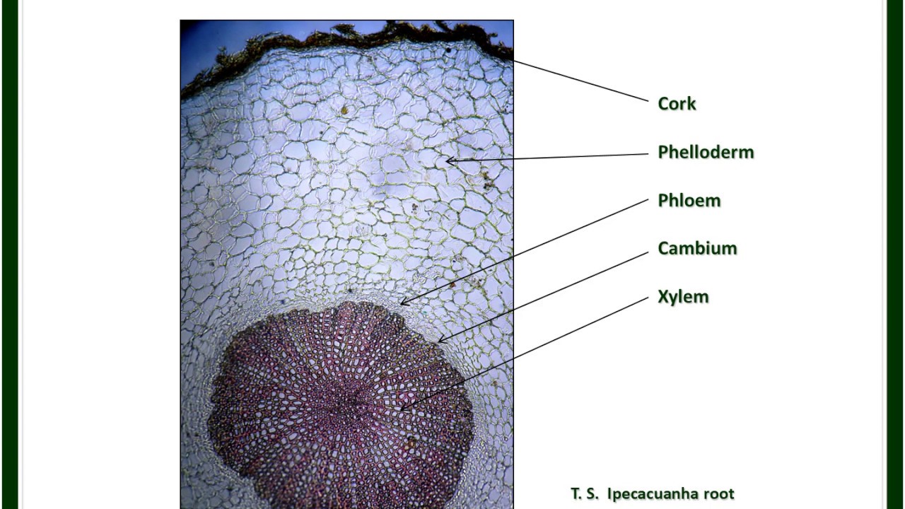 Ipecac Root Microcopy K S Laddha ICT - YouTube