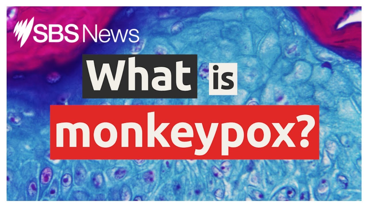 Monkeypox explained: what you need to know about the outbreak | SBS ...
