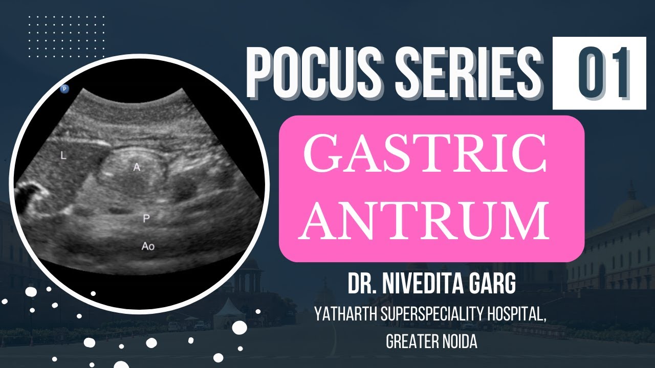 POCUS Gastric Antrum: Enhancing Patient Safety Through Ultrasound I Dr ...