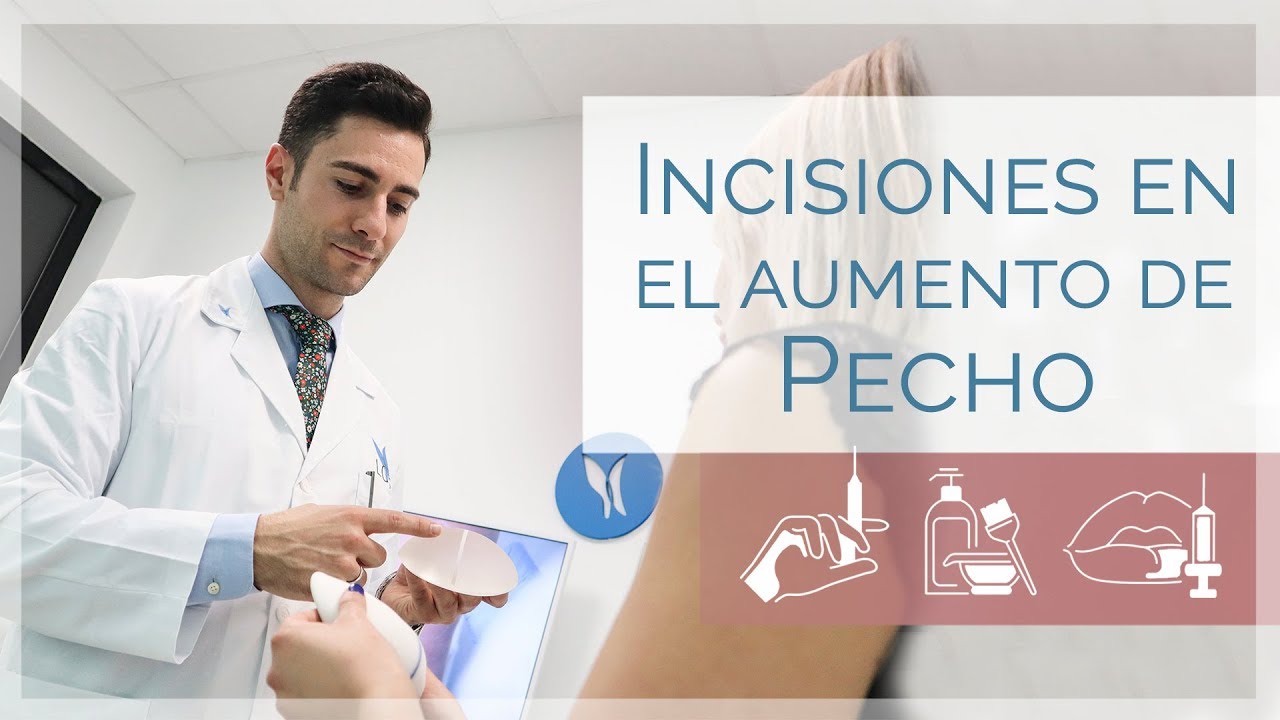 Aumento de pecho: tipos incisiones en el abordaje mamario | Dr. Godoy ...