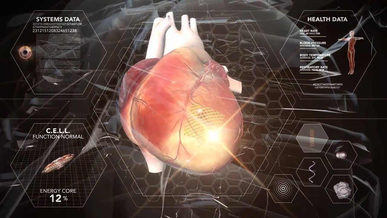 Heart Surgery -Tissue Scaffolding - YouTube