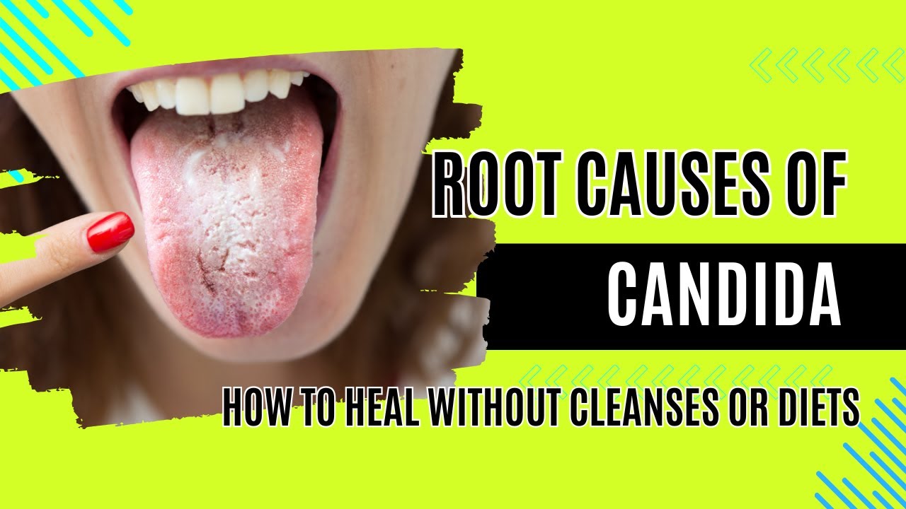 Root Causes of Candida - YouTube