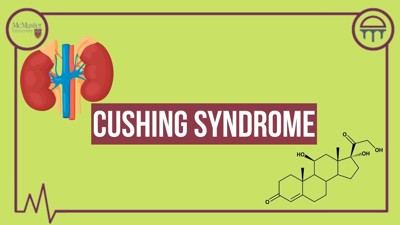 Cushing Syndrome Causes Symptoms Diagnosis And Treatment Youtube