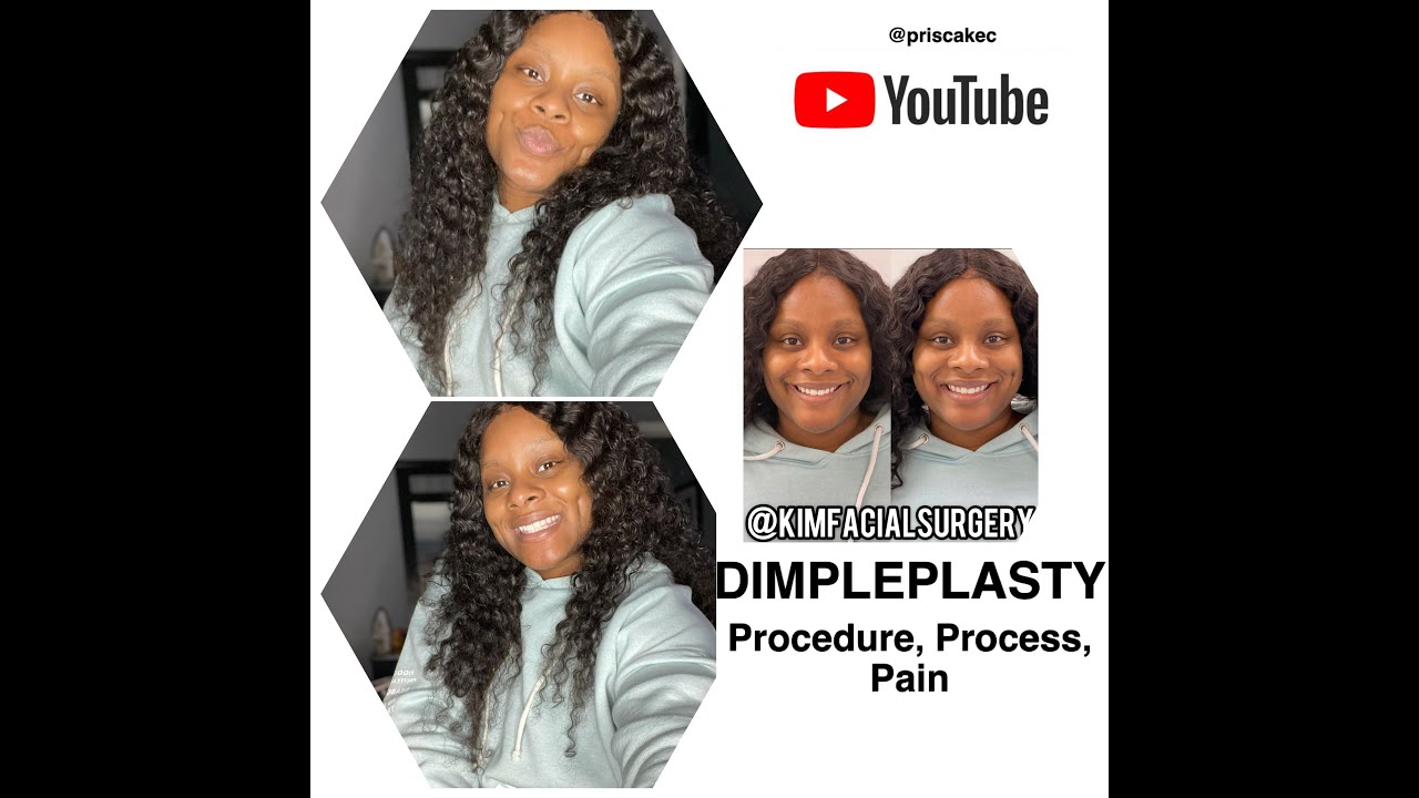 DIMPLEPLASTY VLOG- PROCEDURE, PROCESS & PAIN - YouTube
