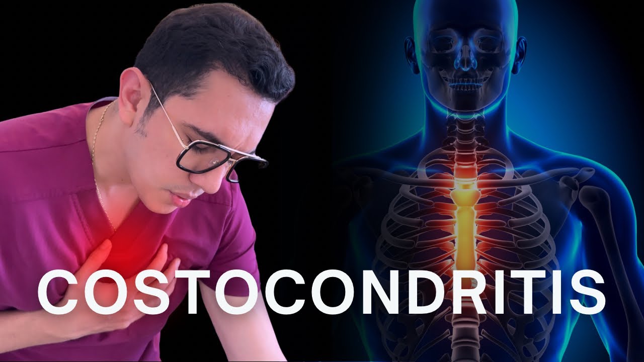 Dolor en el pecho por Costocondritis. ¿Es peligroso? | Dr. William ...